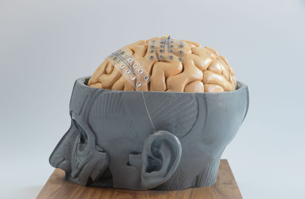 The FDA finally approved Elon Musk’s Neuralink chip for human trials ...